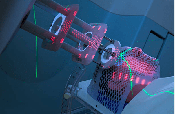 Rôle du Manipulateur Radio